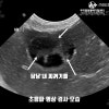 강아지 배가 딱딱해서 검사 받으러 갔어요 초음파 검사에서 담낭이 이상한 걸 발견했어요 강아지 담낭점액종 수술
